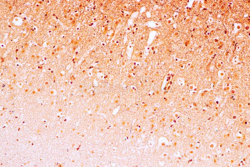 Spinal Cord, Nerve, Cerebellum, Cortex and Motor Neuron Human Under the ...
