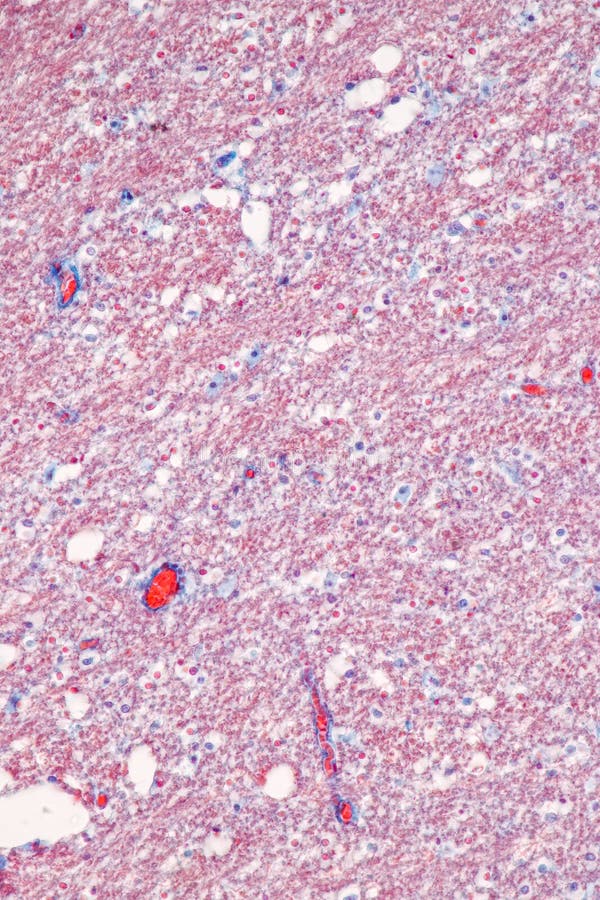 Spinal Cord, Nerve, Cerebellum, Cortex and Motor Neuron Human Under the ...