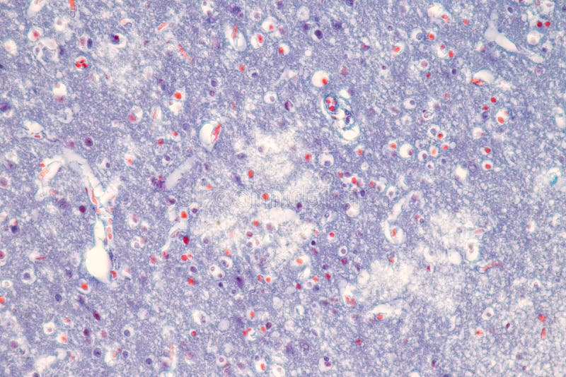 Spinal Cord, Nerve, Cerebellum, Cortex and Motor Neuron Human Under the ...