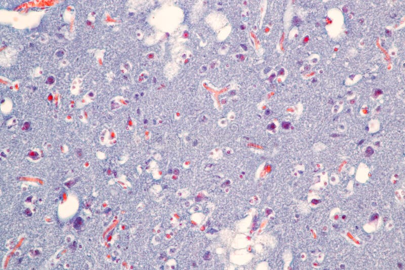 Spinal Cord, Nerve, Cerebellum, Cortex and Motor Neuron Human Under the ...