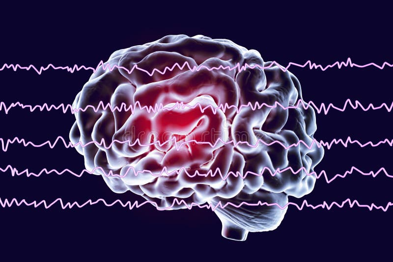 Brain Wave on Electroencephalogram EEG Stock Illustration ...