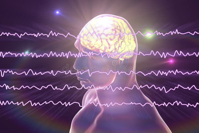 Electroencephalogram EEG. Anatomy Human Brain. Stock Illustration ...