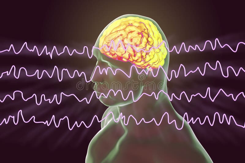 Electroencephalogram EEG. Anatomy Human Brain. Stock Illustration ...