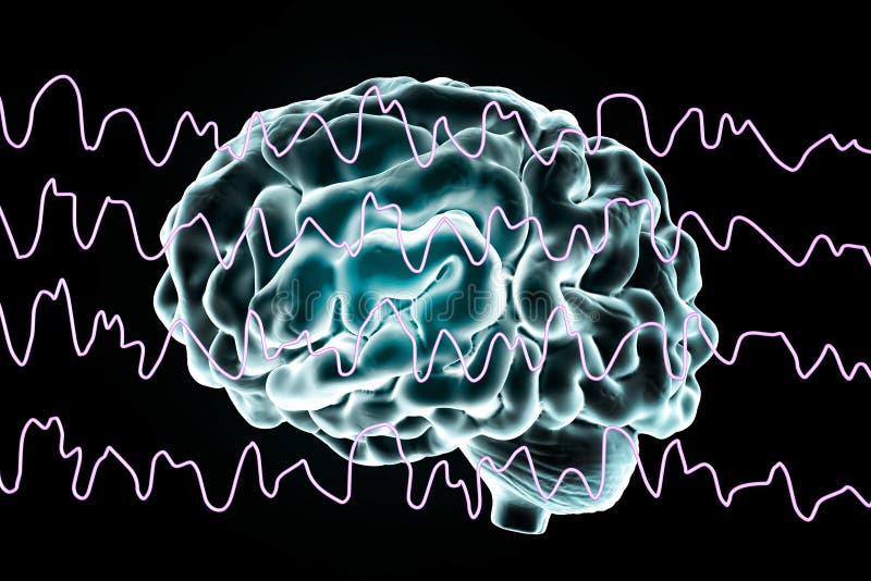Electroencephalogram EEG. Anatomy Human Brain. Stock Illustration ...