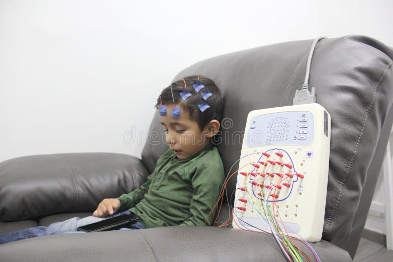 EEG Electroencephalogram of a 3-year-old Boy with Cables and Electrodes ...