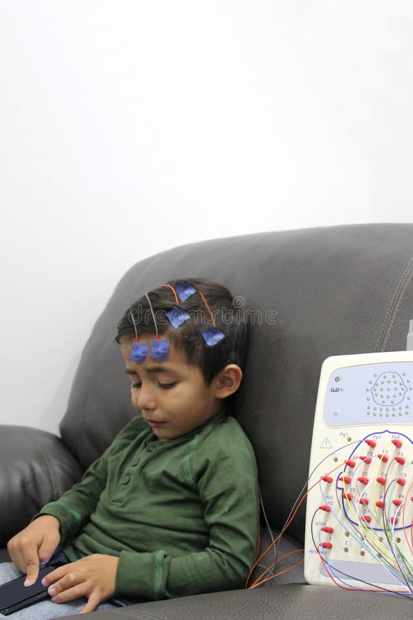 EEG Electroencephalogram of a 3-year-old Boy with Cables and Electrodes ...