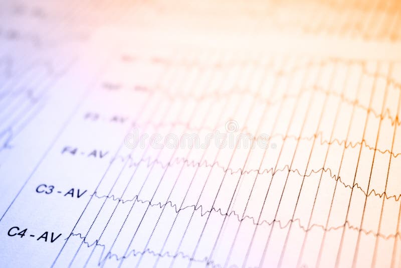 Diagram Eeg Stock Photos - Free & Royalty-Free Stock Photos from Dreamstime