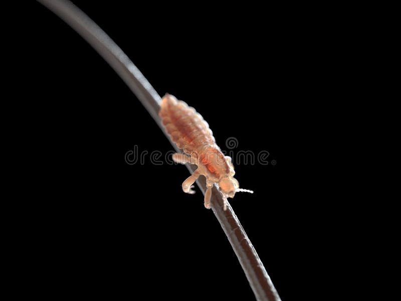 Een hoofdluis stock foto. Image of parasiet, biologie - 127829464