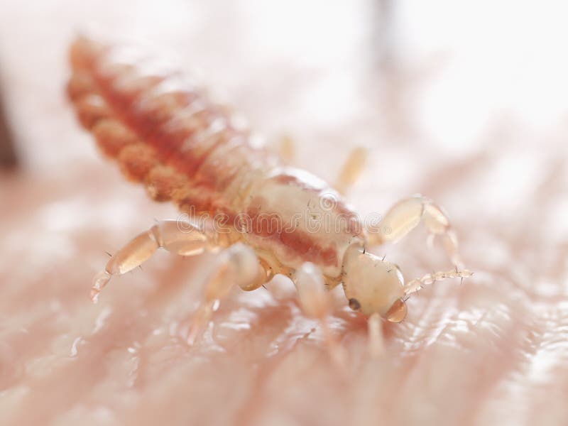 Een hoofdluis stock foto. Image of parasiet, biologie - 127829464