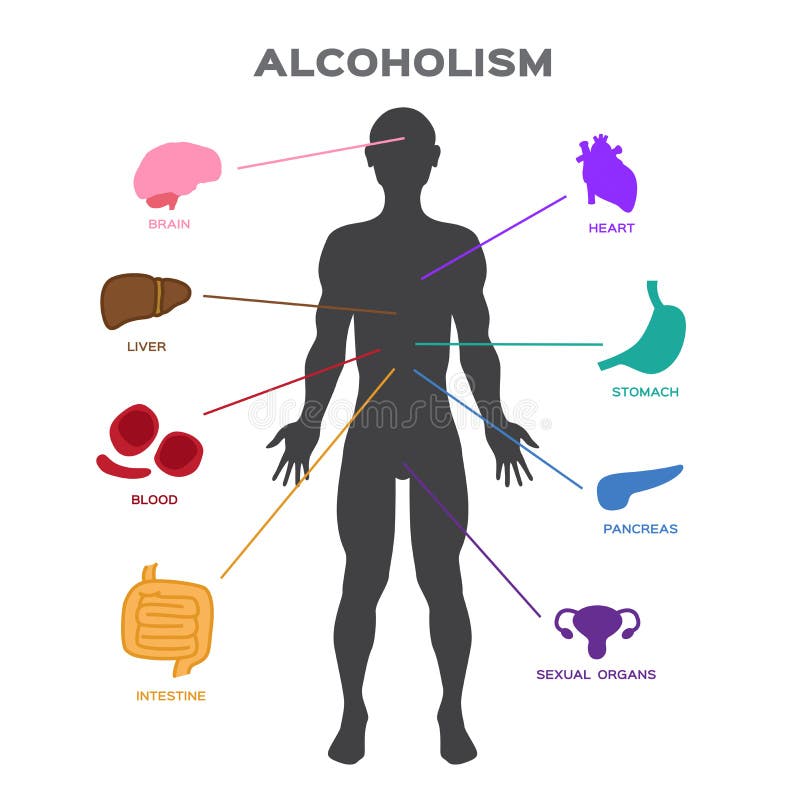 Effet D'alcoolisme Au Corps Humain Anatomie Illustration de Vecteur ...