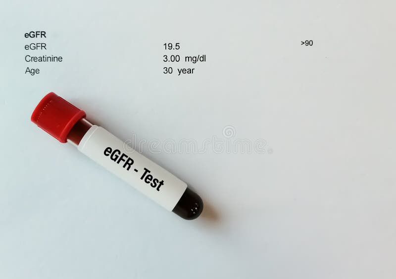 EGFR Test with Abnormal Report, CKD Stock Image - Image of creatinine ...