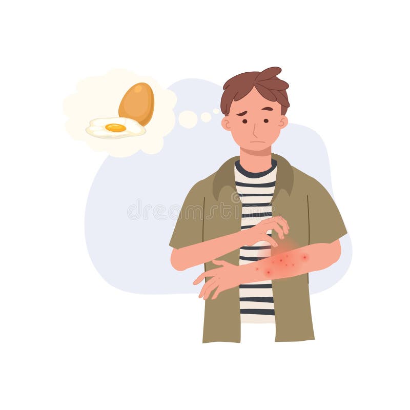 Egg Allergy Reaction. Man with Itchy Red Rash on Arm Stock Vector ...