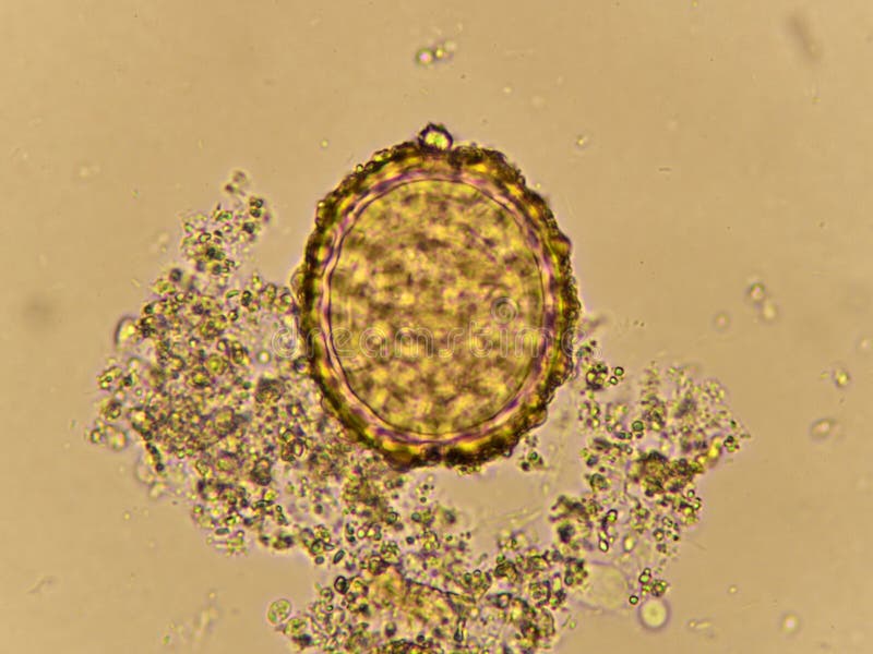 Egg of Ascaris Lumbricoides Roundworm in Human Stool Stock Photo ...