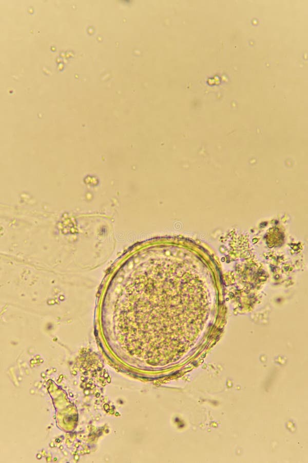 Egg Of Ascaris Lumbricoides In Stool Stock Image - Image of ...