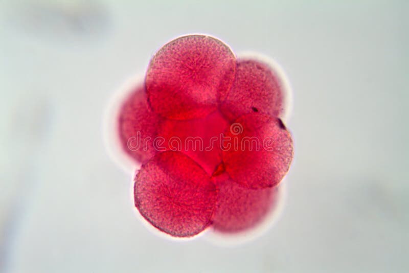 Egg Cell Under the Microscope. Stock Photo - Image of infection ...