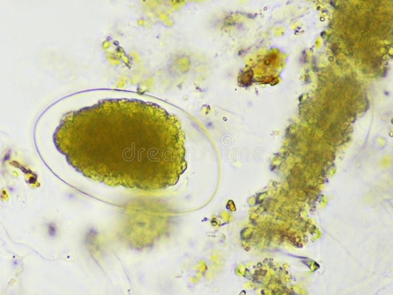 Egg of Hookworm in Human Stool Stock Photo - Image of patient, tapeworm ...