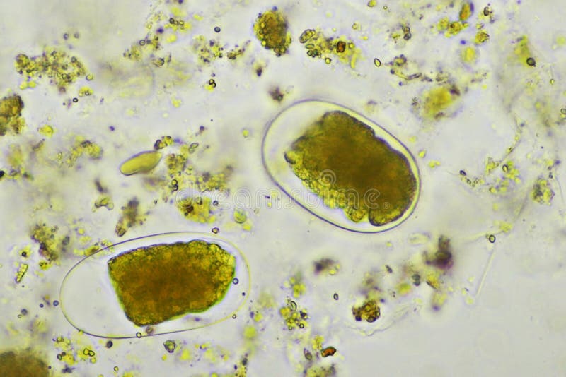 Egg of Hookworm in Human Stool Stock Image - Image of nematode, medical ...