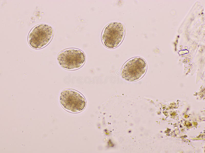 Egg of Hookworm in Human Stool Stock Image - Image of helminths ...