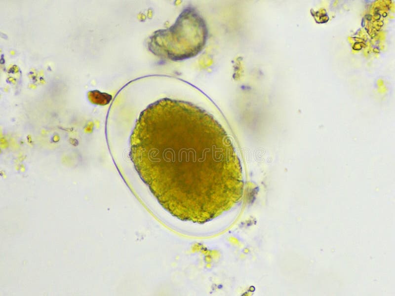 730 Human Tapeworm Stock Photos - Free & Royalty-Free Stock Photos from ...