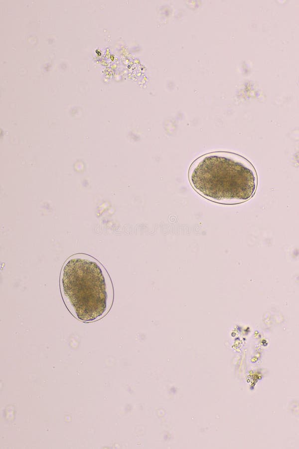 Egg of Hookworm in Human Stool Stock Photo - Image of 400x, microscope ...