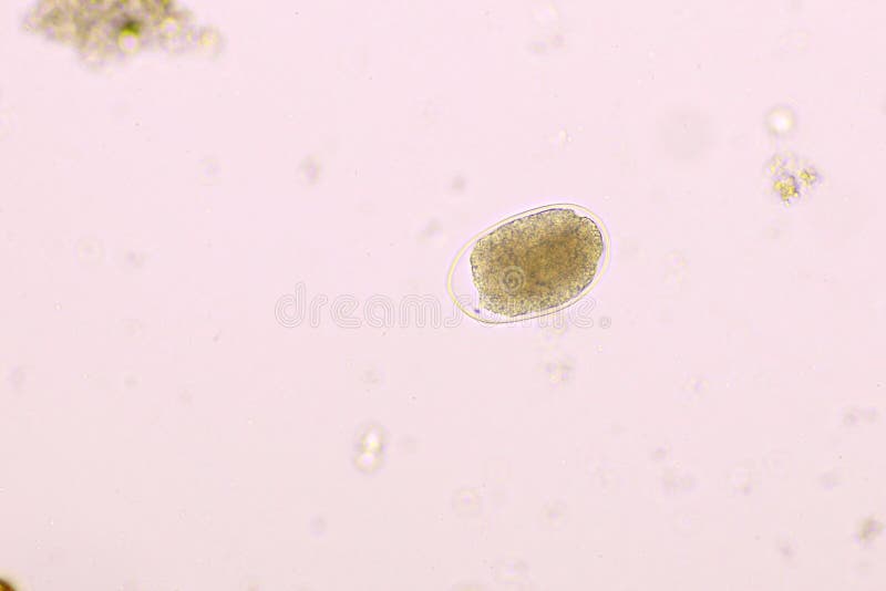 Egg of Hookworm in Human Stool Stock Photo - Image of 400x, microscope ...