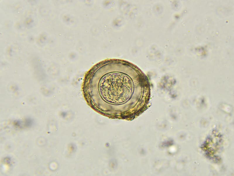 Egg of Hymenolepis stock image. Image of diminuta, hymenolepis - 80031129