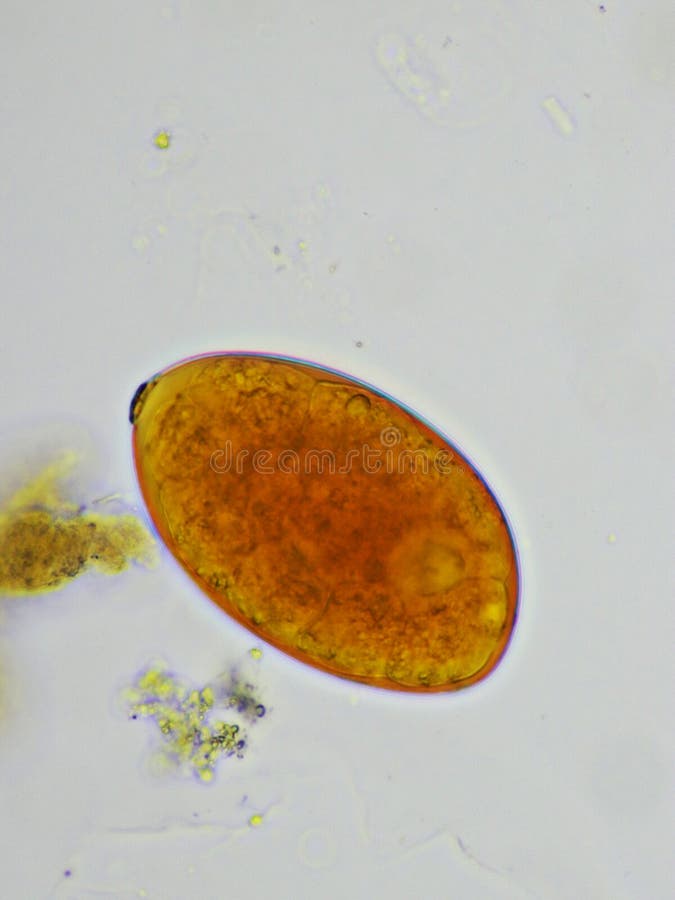 Egg of Intestinal Fluke in Human Stool Stock Image - Image of feces ...