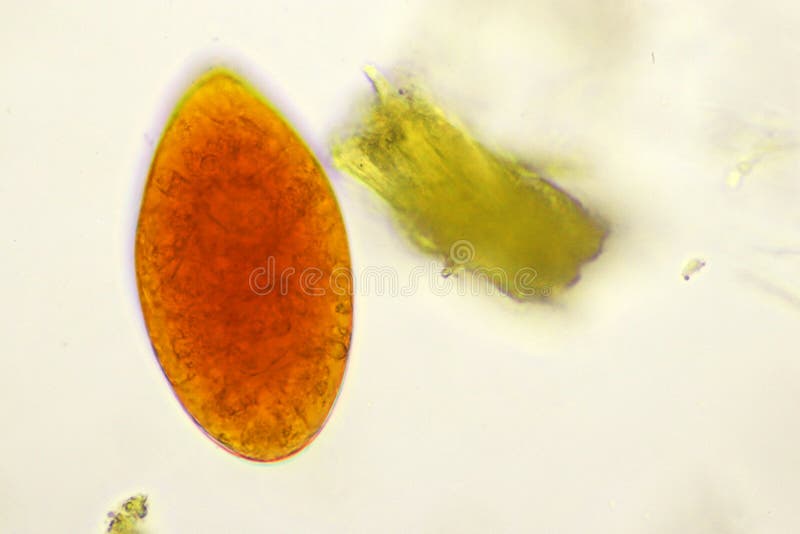 Egg of Intestinal Fluke in Human Stool Stock Image - Image of analyzing ...