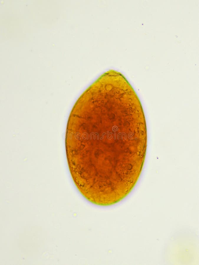 Egg of Intestinal Fluke in Human Stool Stock Photo - Image of ...