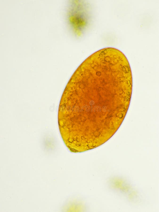 Egg of Intestinal Fluke in Human Stool Stock Image - Image of nematode ...
