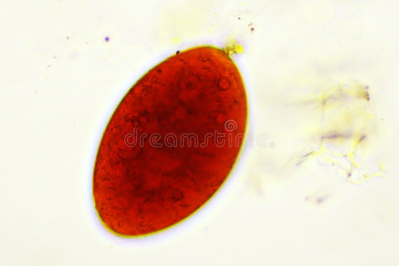 Egg of Intestinal Fluke in Human Stool Stock Image - Image of ...