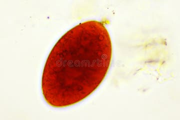Egg of Intestinal Fluke in Human Stool Stock Image - Image of ...