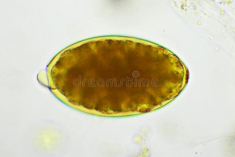 Intestinal Flukes In Stool