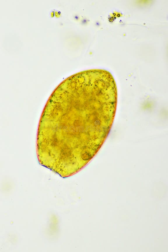 Egg of Intestinal Fluke in Human Stool Stock Image - Image of minute ...
