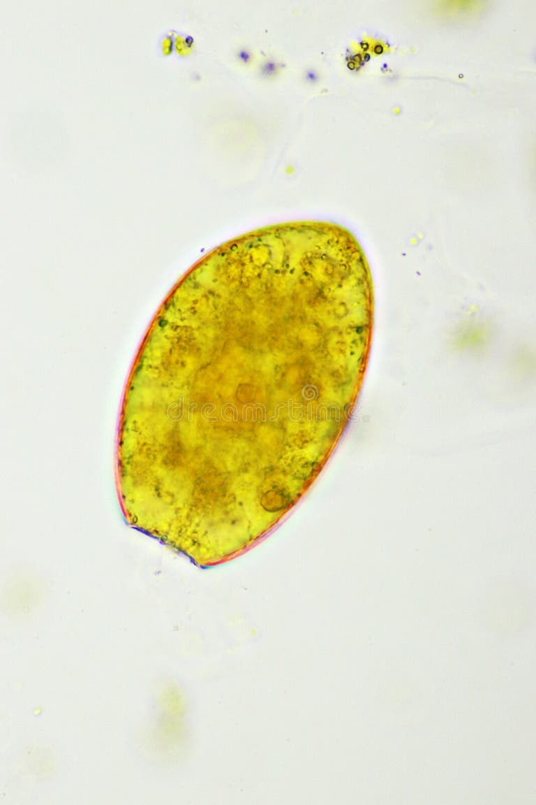 208 Intestinal Fluke Stock Photos - Free & Royalty-Free Stock Photos ...