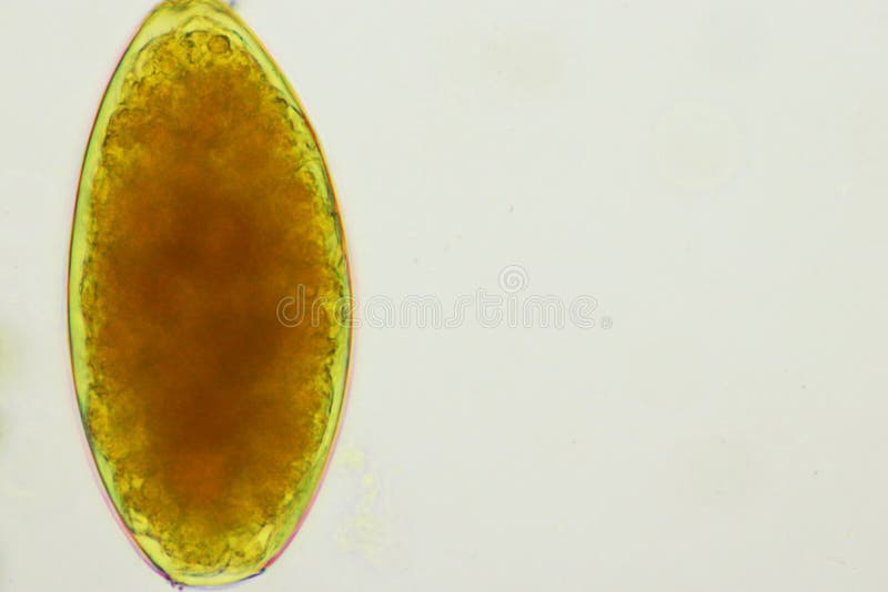 Egg of Intestinal Fluke in Human Stool Stock Image - Image of ...