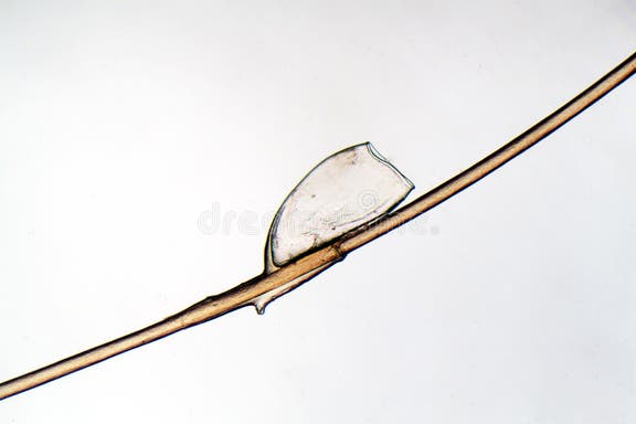 Egg or Nit of a Head Louse, Pediculus Humanus, on a Human Hair Stock ...