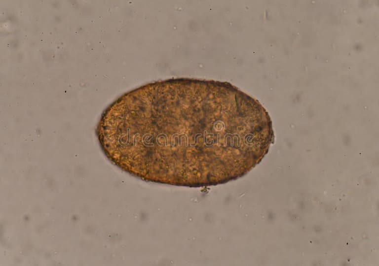Roundworm Eggs Under Microscope Stock Photos - Free & Royalty-Free ...