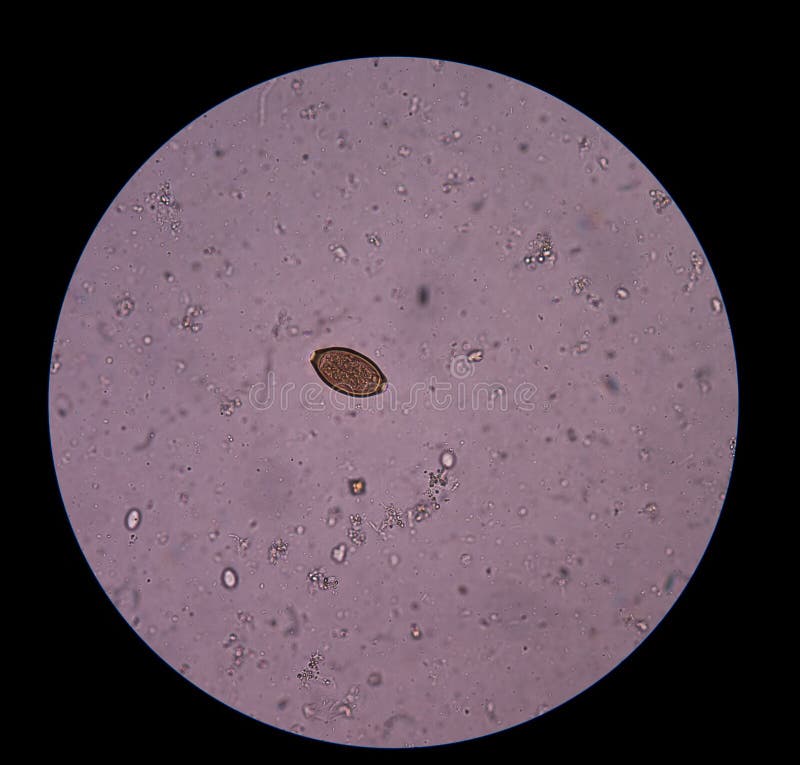 Egg parasite. stock image. Image of microscopic, nematode - 67925955
