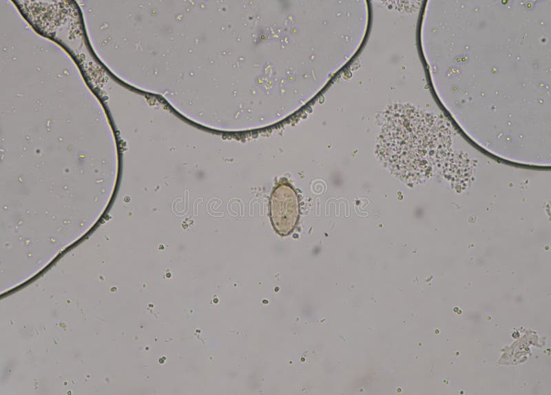 Egg of Parasite in Stool Examition Testing Stock Image - Image of ...