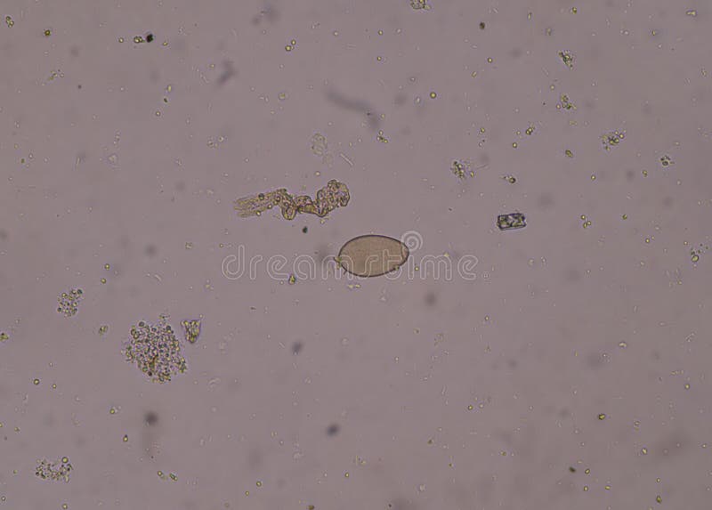 Egg of Parasite in Stool Examition Testing Stock Image - Image of cell ...