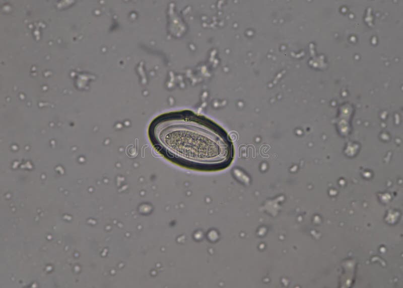 Egg of Parasite in Stool Examition Testing Stock Image - Image of ...
