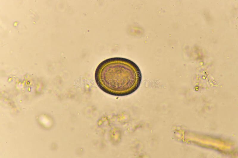 Egg of Taenia in stool stock photo. Image of protozoa - 110465598