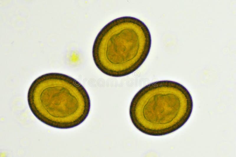 Egg of Taenia or Tapeworm in Human Stool Stock Image - Image of ...