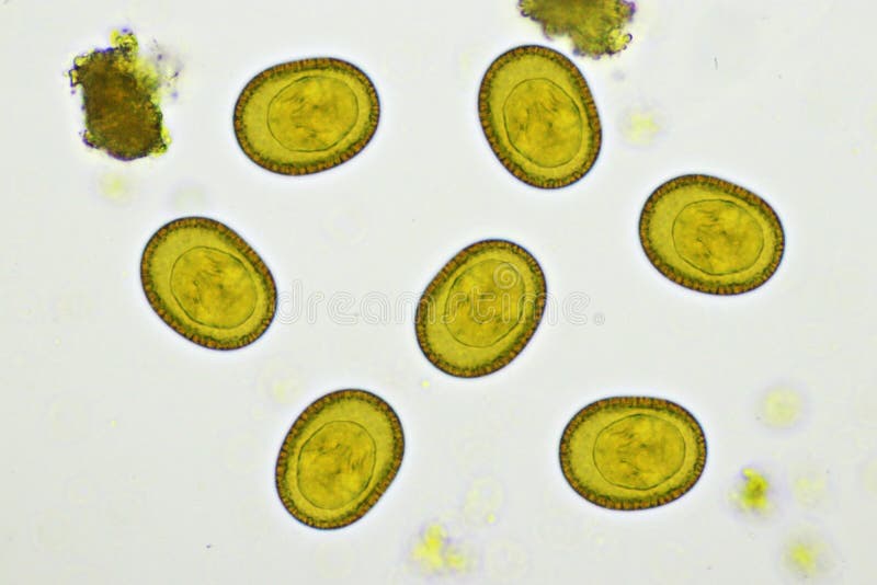 Egg of Taenia or Tapeworm in Human Stool Stock Photo - Image of ...