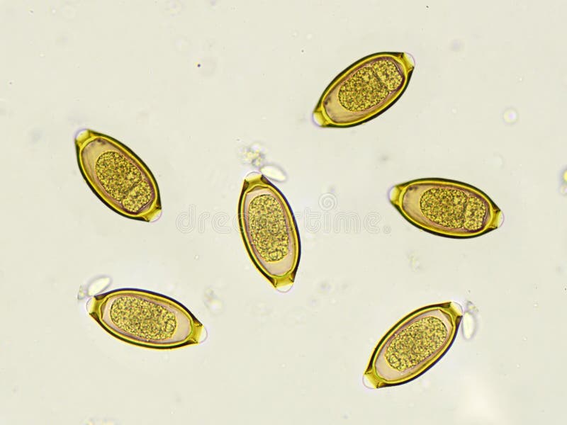 Egg of Trichuris Trichiura (whipworm) Stock Image - Image of ...