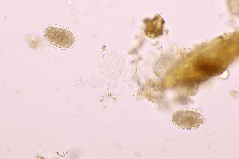 Hookworm Under Microscope