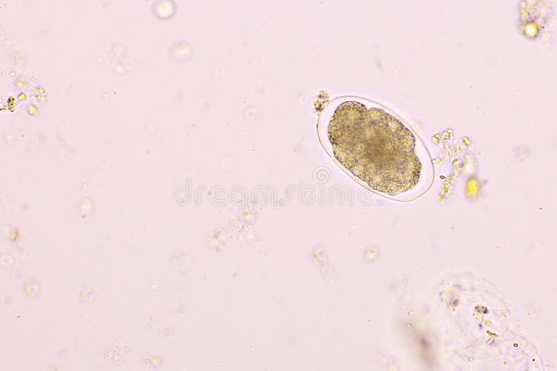 Hookworm Under Microscope