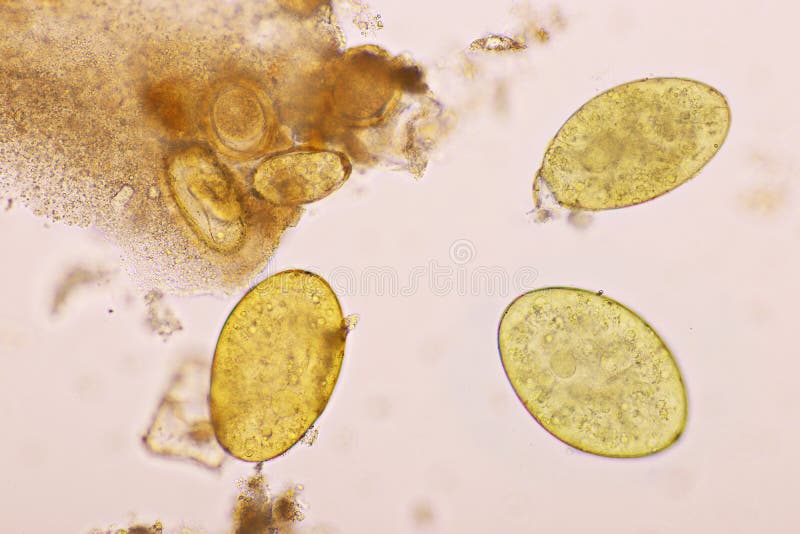 Eggs of Intestinal Fluke in Human Stool Stock Image - Image of ...