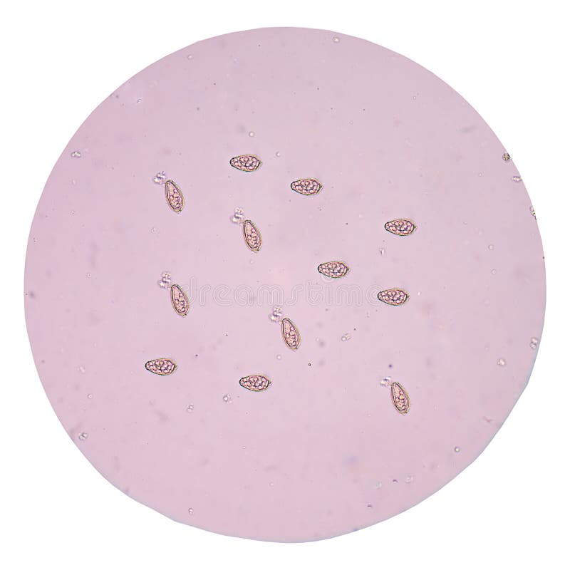 Parasites In Stool Sample